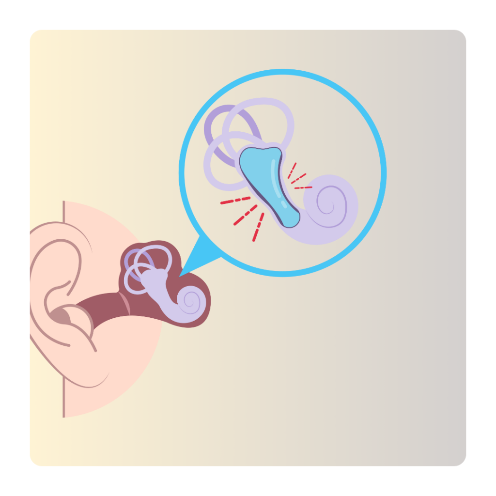 Hearing Loss – House of Hearing Malaysia